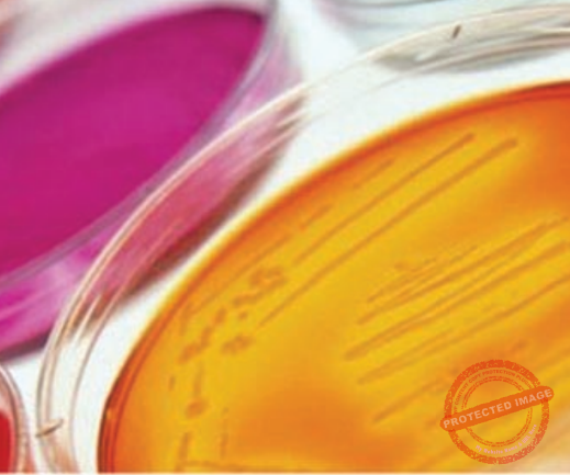 ABC Of Sepsis ! - ExcelReads